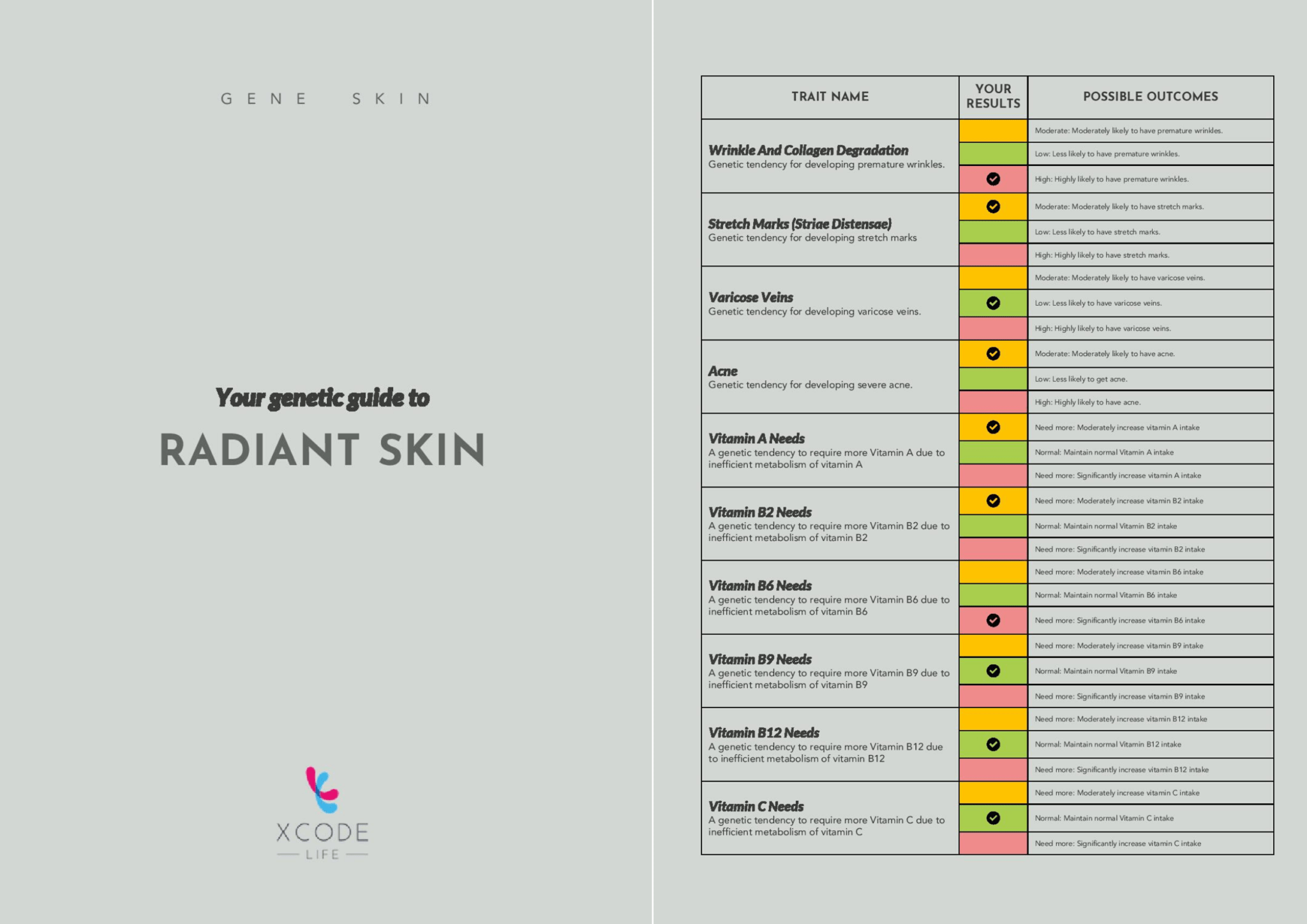 5 Things You Should Know Before Buying Xcode Life - Xcode Life