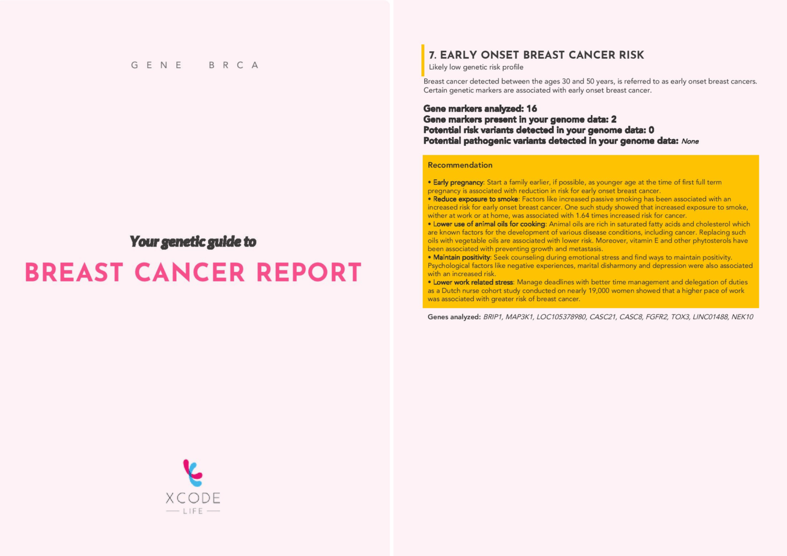 5 Things You Should Know Before Buying Xcode Life - Xcode Life