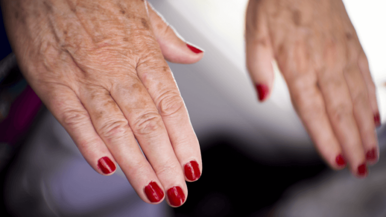 Is Gout Hereditary? How To Identify Your Genetic Risk?