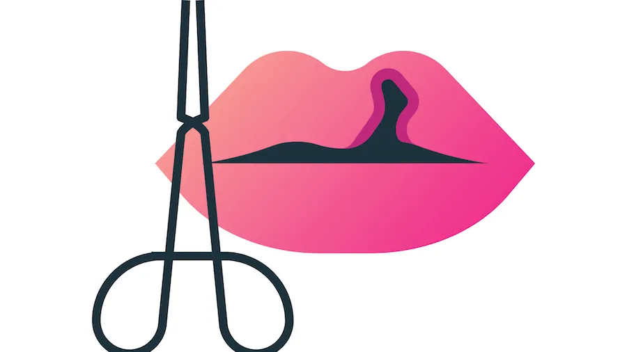 Is Cleft Lip Genetic? Facts about Cleft Lip and Palate