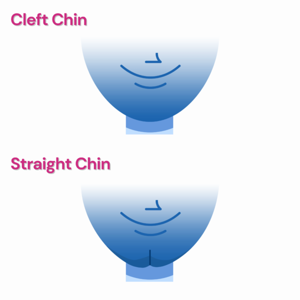 Cleft Chin And Genetics: Is It Inherited?